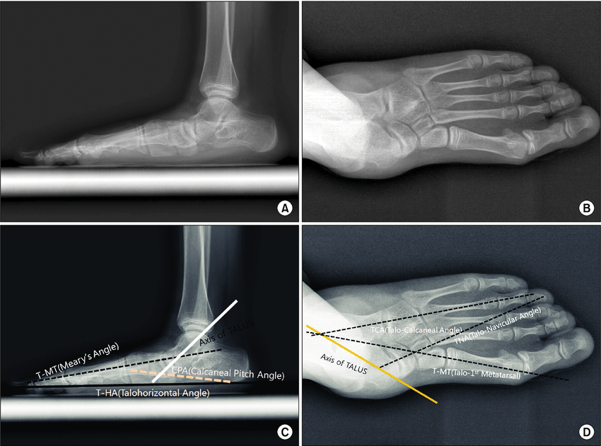 What's new 27/11/2021 - gerakasphysiotherapy.gr