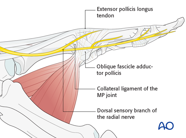 Gamekeeper's Thumb - Stener Lesion - gerakasphysiotherapy.gr
